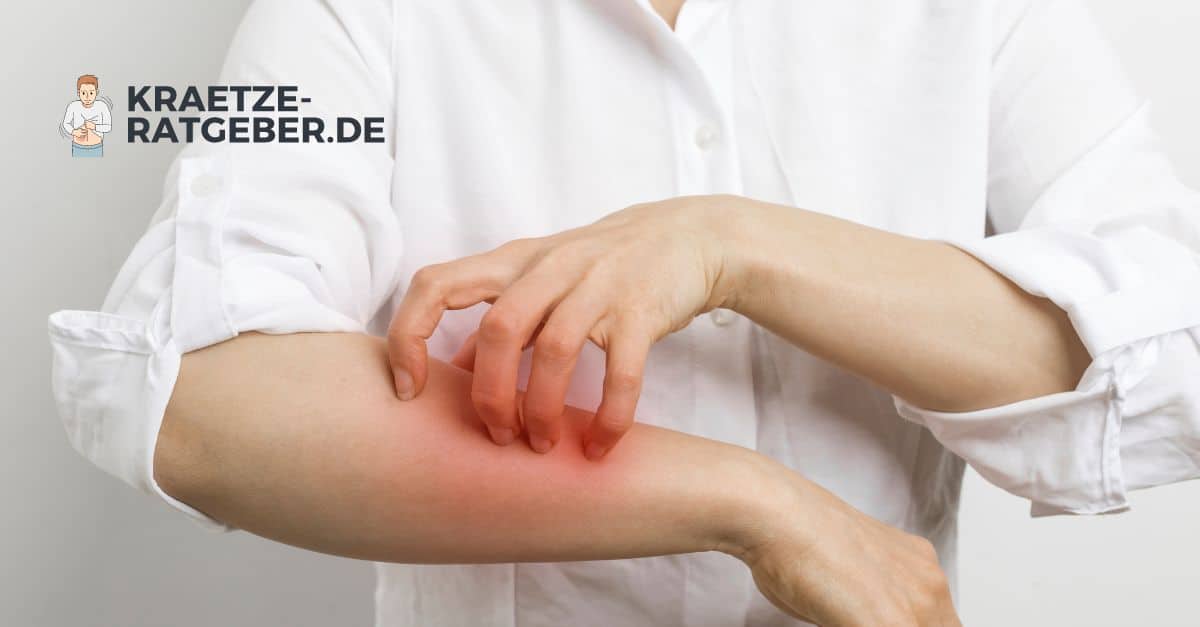 Krätze-Scabies Blog - kraetze-ratgeber.de